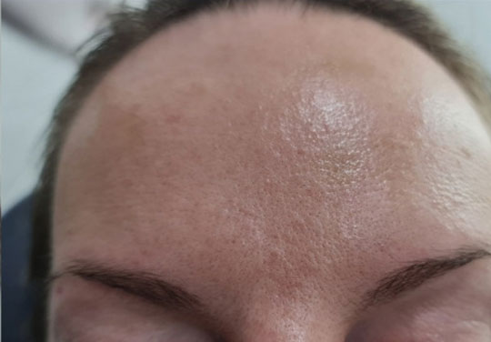 Pre i posle - Hair and Skin